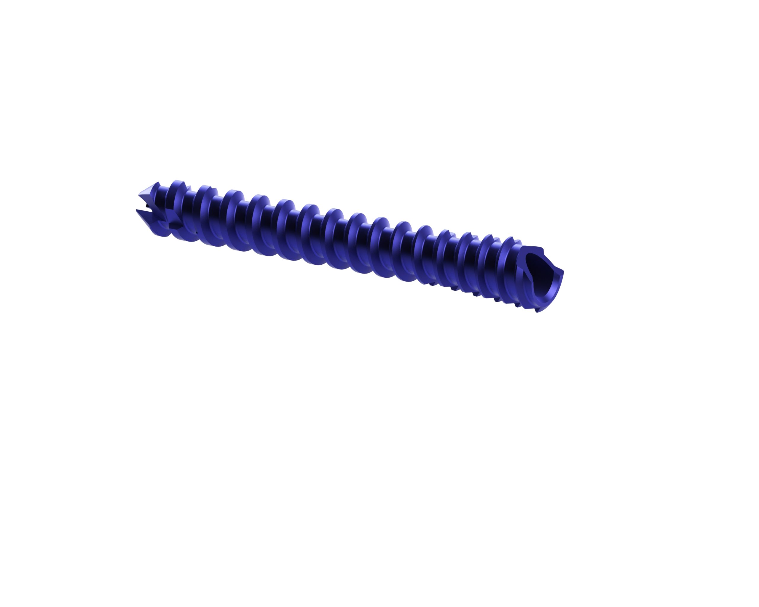 HALLUX VALGUS OPERATION: THE SCREWS MAKE THE DIFFERENCE - Leghe Leggere